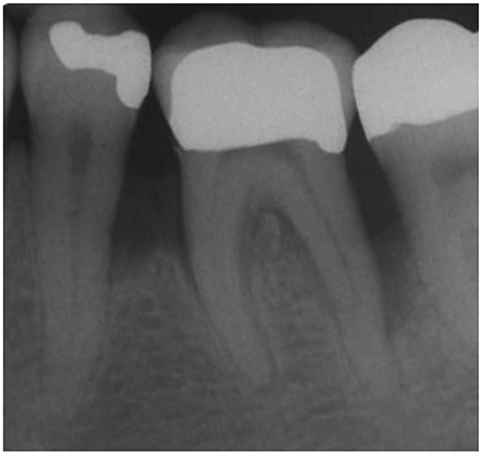Parodontitisbehandlung - Praxis Priv.-Doz. Dr. KanerPraxis Priv.-Doz ...