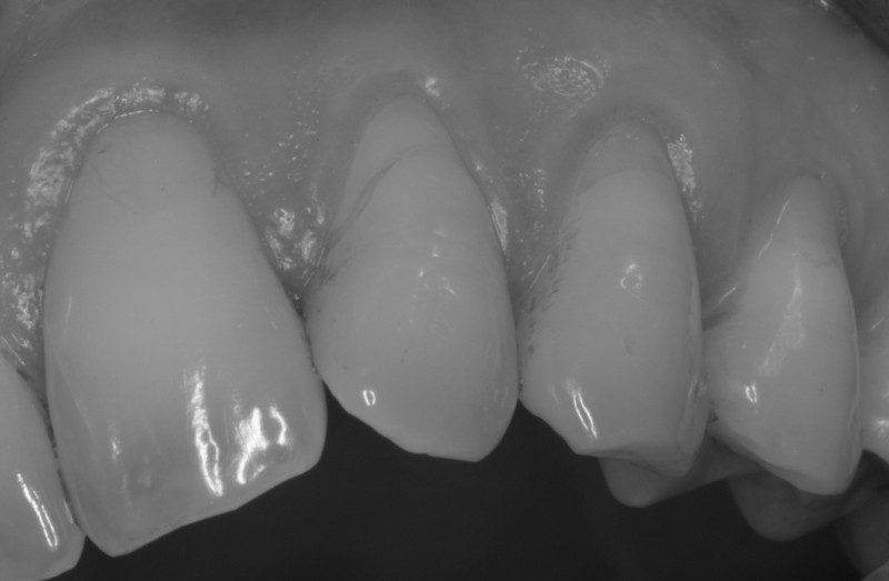 Plastische Parodontalchirurgie - Praxis Priv.-Doz. Dr. KanerPraxis Priv ...