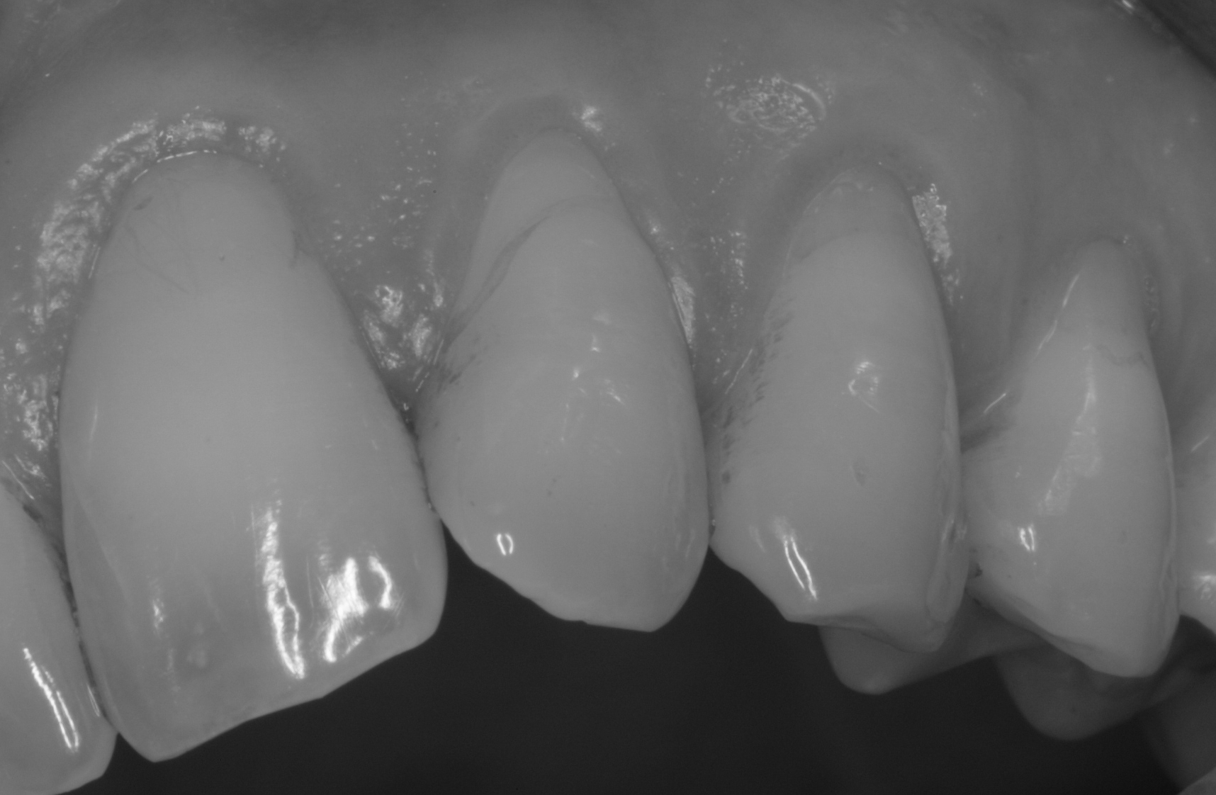 Plastische Parodontalchirurgie - Praxis Priv.-Doz. Dr. KanerPraxis Priv ...