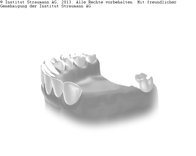 Implantate - Dr. Verch & Priv.-Doz. Dr. KanerDr. Verch & Priv.-Doz. Dr ...